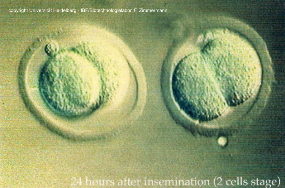 BTL Bildergalerie - Universität Heidelberg