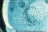 BTL Bildergalerie - Universität Heidelberg